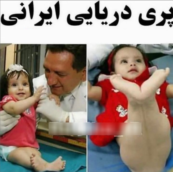 این دختر ایرانی لقب پری دریایی دارد عکس دختر زیبا و عجیب الخلقه